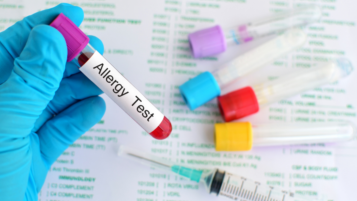 Which Allergy Test Is Right for Me? - Tottori Allergy & Asthma Associates
