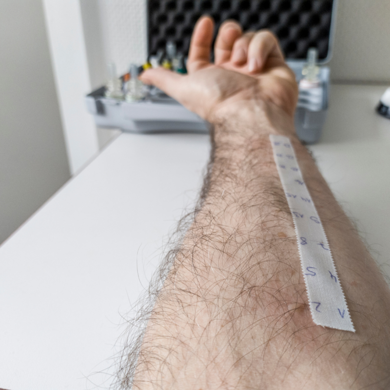 What is Allergy Skin Testing? - Tottori Allergy & Asthma Associates