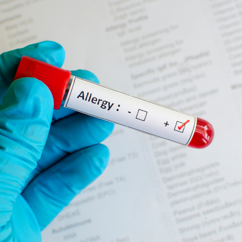 What is Allergy Skin Testing? - Tottori Allergy & Asthma Associates