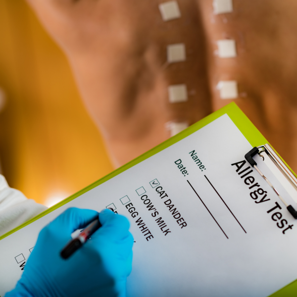 What is Allergy Skin Testing? - Tottori Allergy & Asthma Associates