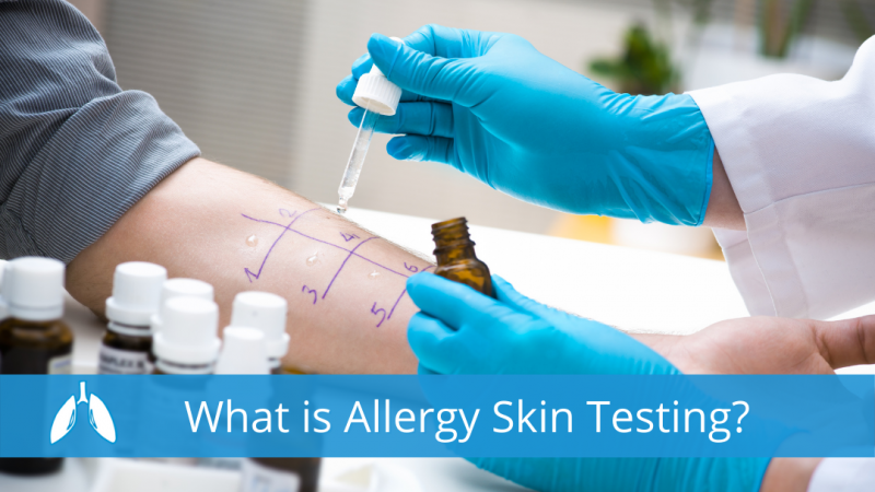 What is Allergy Skin Testing? - Tottori Allergy & Asthma Associates