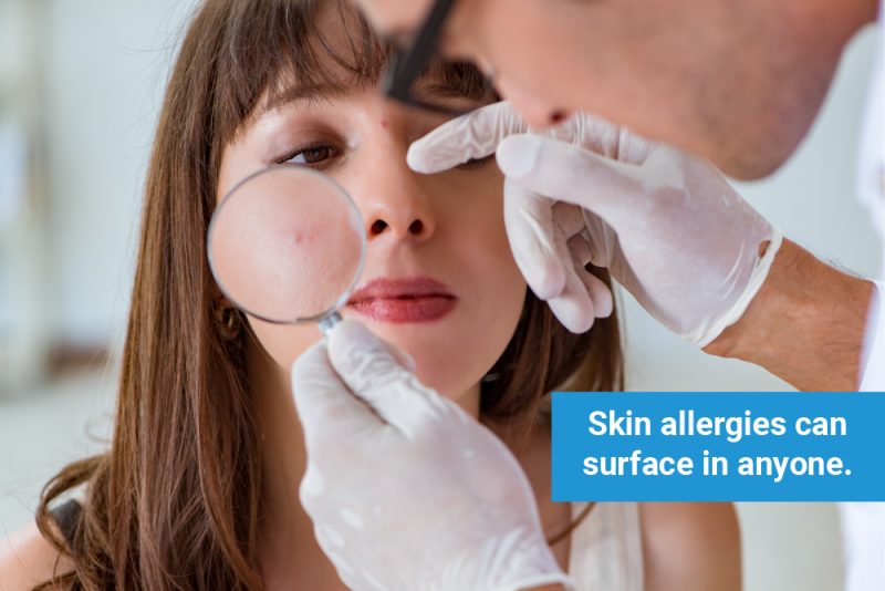Is it Acne or a Cosmetic Allergy? Here’s How to Tell - Tottori Allergy ...