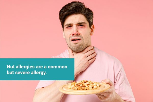 What You Need to Know About Nut Allergies - Tottori Allergy & Asthma ...