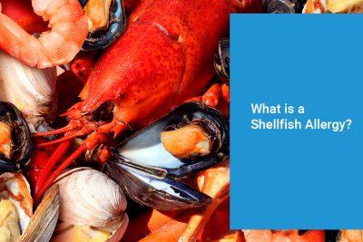 Shellfish Allergies: Facts vs. Fiction - Tottori Allergy & Asthma ...