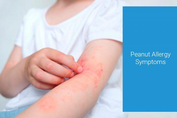 Facts About Peanut Allergies - Tottori Allergy & Asthma Associates