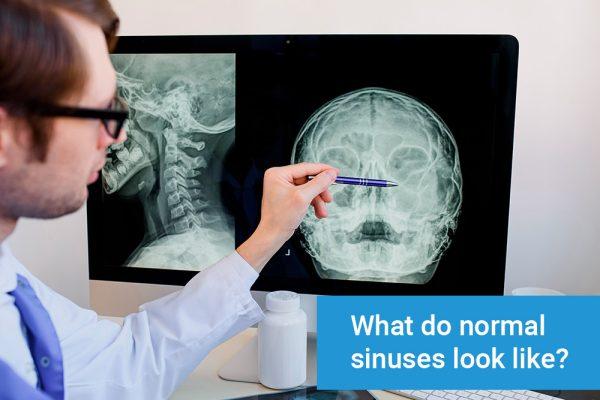 Allergies and Sinusitis in Las Vegas - Tottori Allergy & Asthma Associates